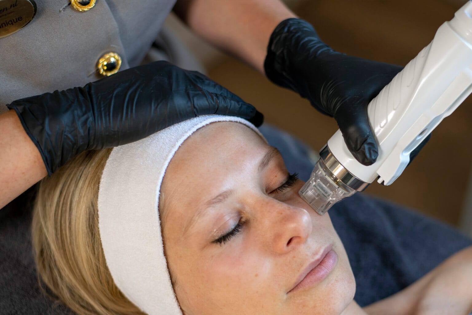 Microneedling RF: huidverjonging met zichtbaar effect
